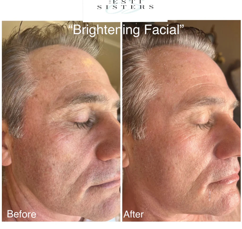 Skin Brightening Facial Bundle by Expert Backbar Skincare